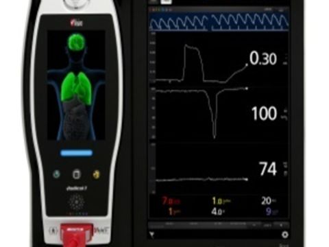 New Clinical Study Reports Relationship Between Masimo’s ORI™& Arterial ...