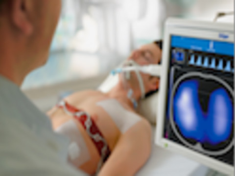 New insights into the lung: EIT device from Dräger revolutionises ventilation monitoring