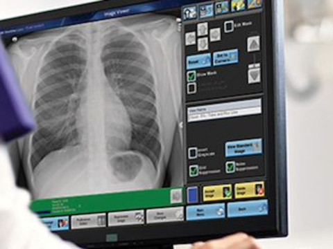 Carestream Digital X-ray System Receives Top Award