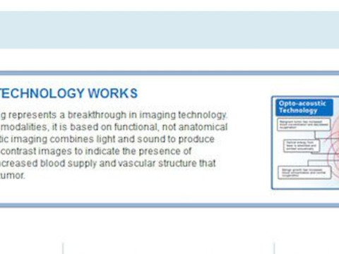 Data: Seno Medical Instruments’ Imagio® Might Eliminate Breast Biopsy Need