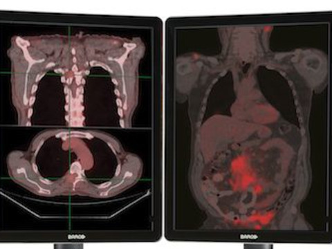 RSNA 2013: Barco Launches Nio Color 2MP LED Diagnostic Display
