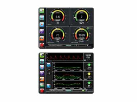FDA Clearance For Edwards’ Advanced Noninvasive Monitoring System