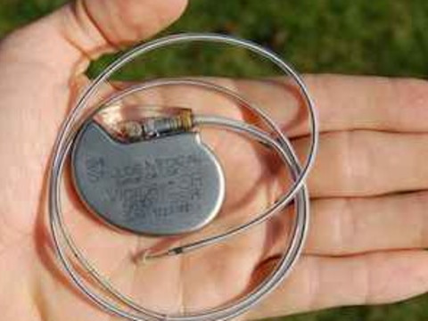 Pacemaker Checks Help Prevent Stroke