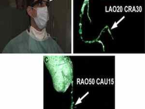 Virtual Reality Imaging in Cardiac Cath Lab to Treat Blocked Coronary ...