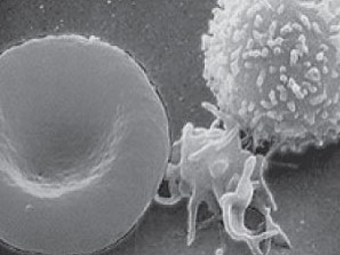 New Therapy for White Blood Cell Impairment in Septic Patients