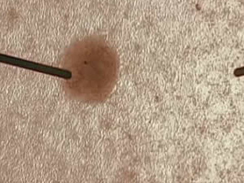 Functional Heart Pacemaker Cells Developed