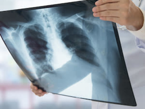 Utility of Chest Radiograph for Clinical Diagnosis of COVID-19