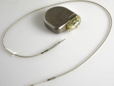 Risk of Anxiety, Depression After Cardiac Device Implantation