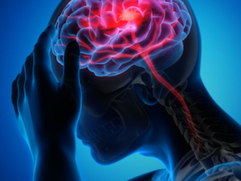 The Evolution of Cerebrovascular Critical Care