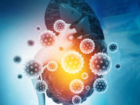 AKI in Critically Ill Patients With COVID-19