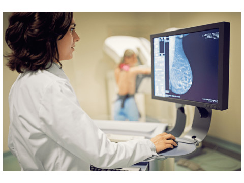 New DECT-Based Model for Differentiating Benign and Malignant Breast ...