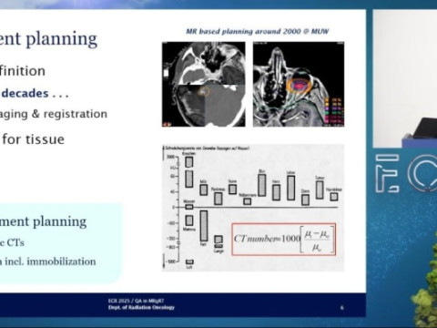MRI Quality and Radiotherapy Planning