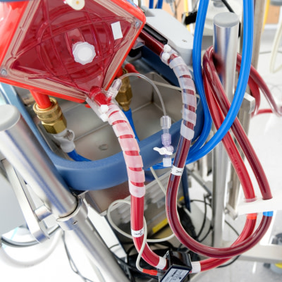 REMEMBER score predicts mortality in patients receiving VA-ECMO after ...