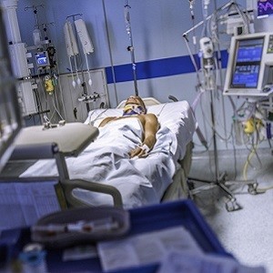 Outcomes of ABCDE Bundle in Mechanically Ventilated Patients ...
