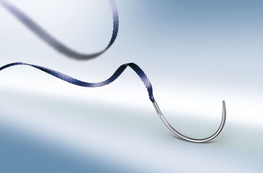 Health Management and Leadership Portal | Suture wire Parenchyma Set ...