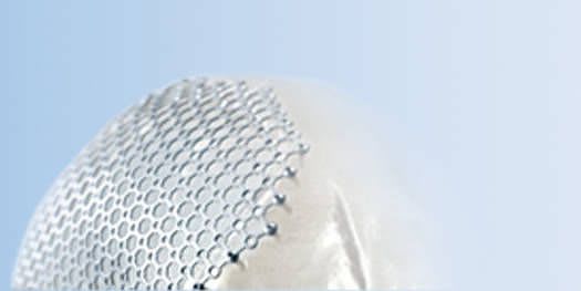 Health Management and Leadership Portal | Cranial implant KLS Martin ...