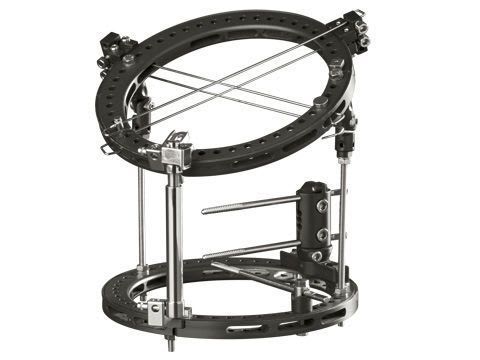 Health Management and Leadership Portal | Human external fixation ...