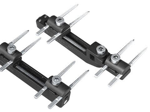 Health Management and Leadership Portal | Human external fixation ...